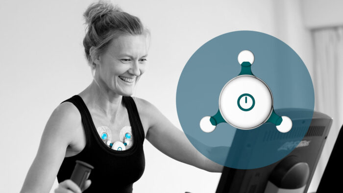 Holter ECG Analysis | Nords Medical
